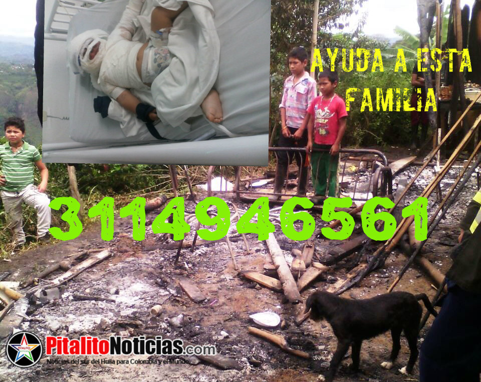 Este bebé quemado en Isnos necesita de su ayuda