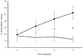 The Boundless Thicket: Time Travel: Maggot Therapy
