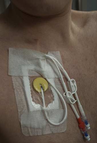 Around the Kitchen Table: Getting ready for Transplant