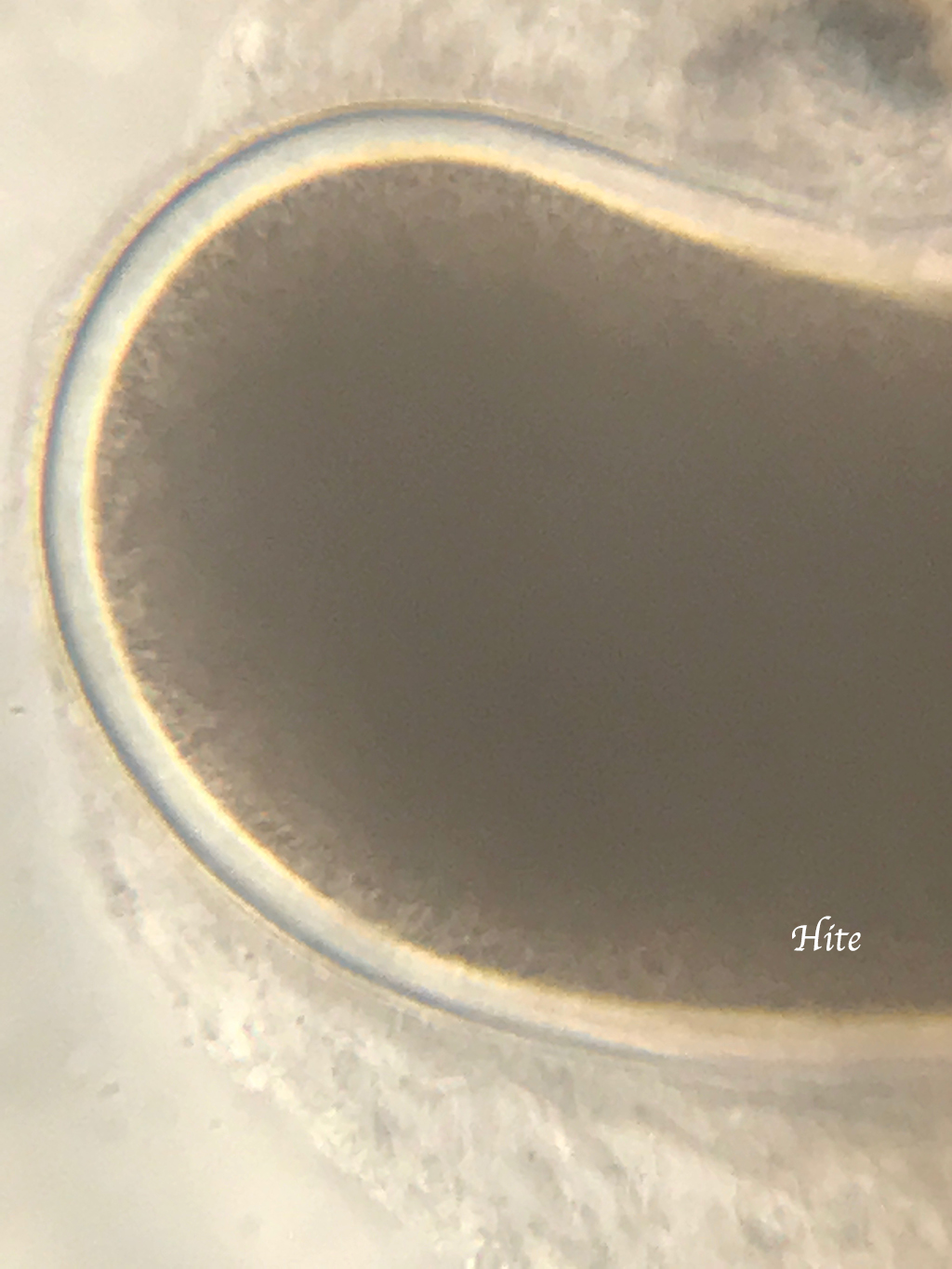 Hite's fish world: Dermocystidium