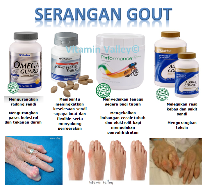 ZAFRANzafrina: TIBA-TIBA ENCIK GOUT SAY HI :-)