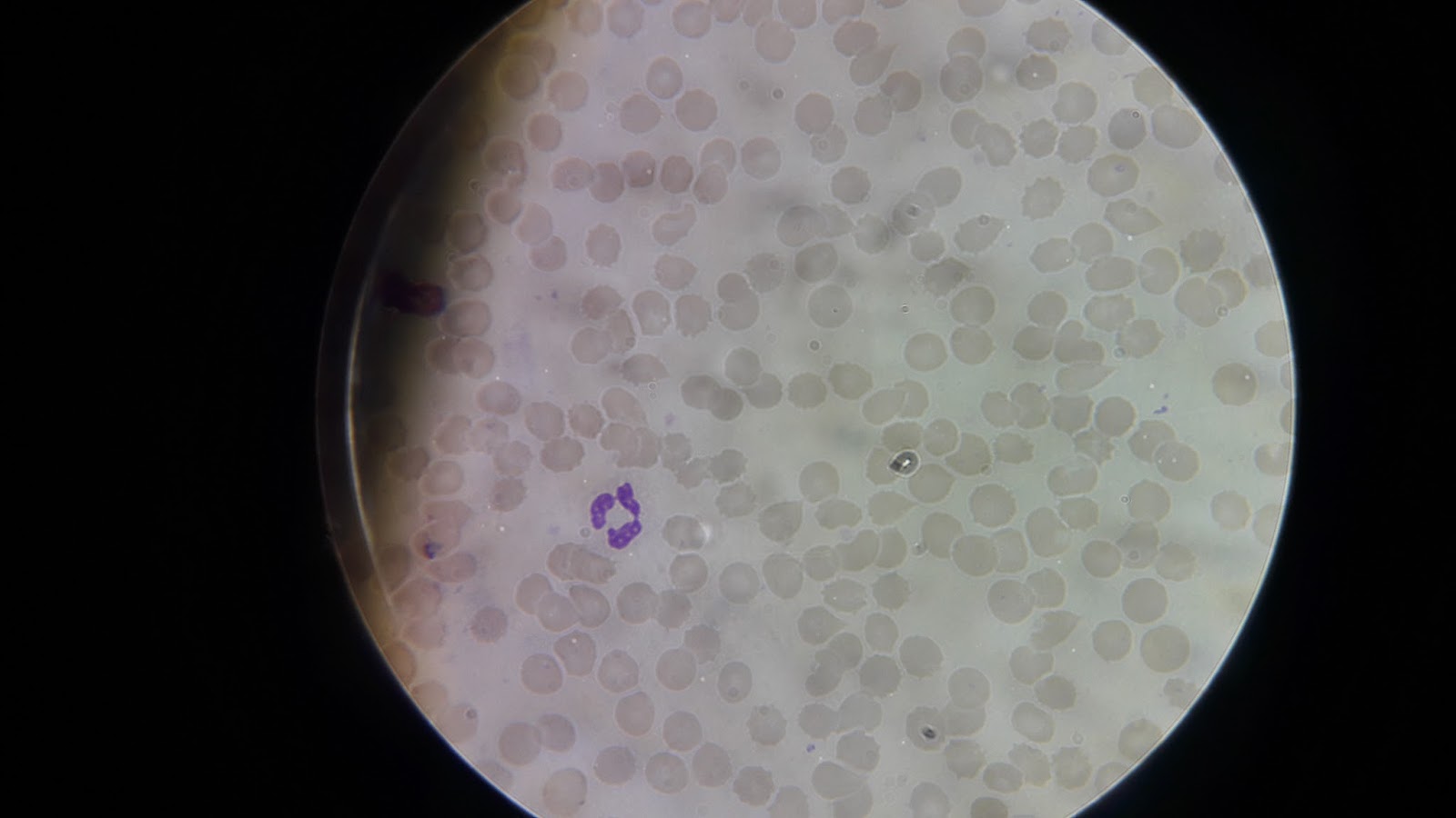 Ilmu Pengetahuan: DIFFERENTIAL COUNT WBC (HITUNG JENIS LEUKOSIT)