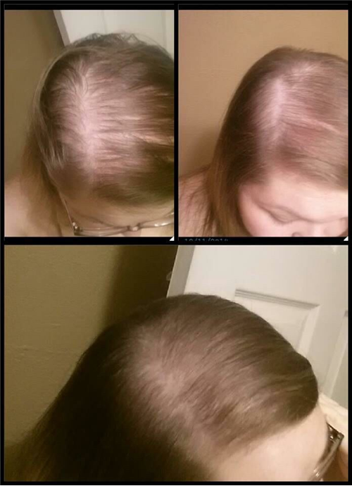 MONAT Global Revolutionary Hair Care Products: Is your hair thinning or ...