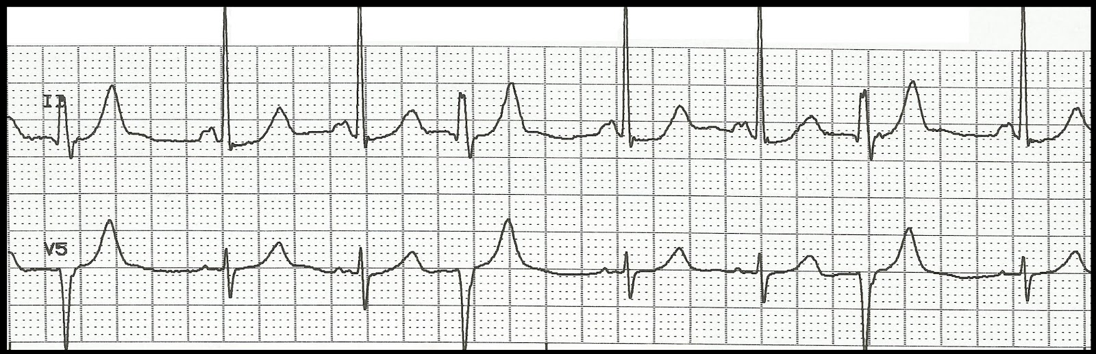 Basic EKG Rhythm Test 04