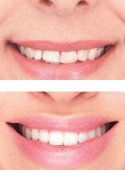 Chirurgie esthétique et plastique: opérations, cliniques, tarif ...