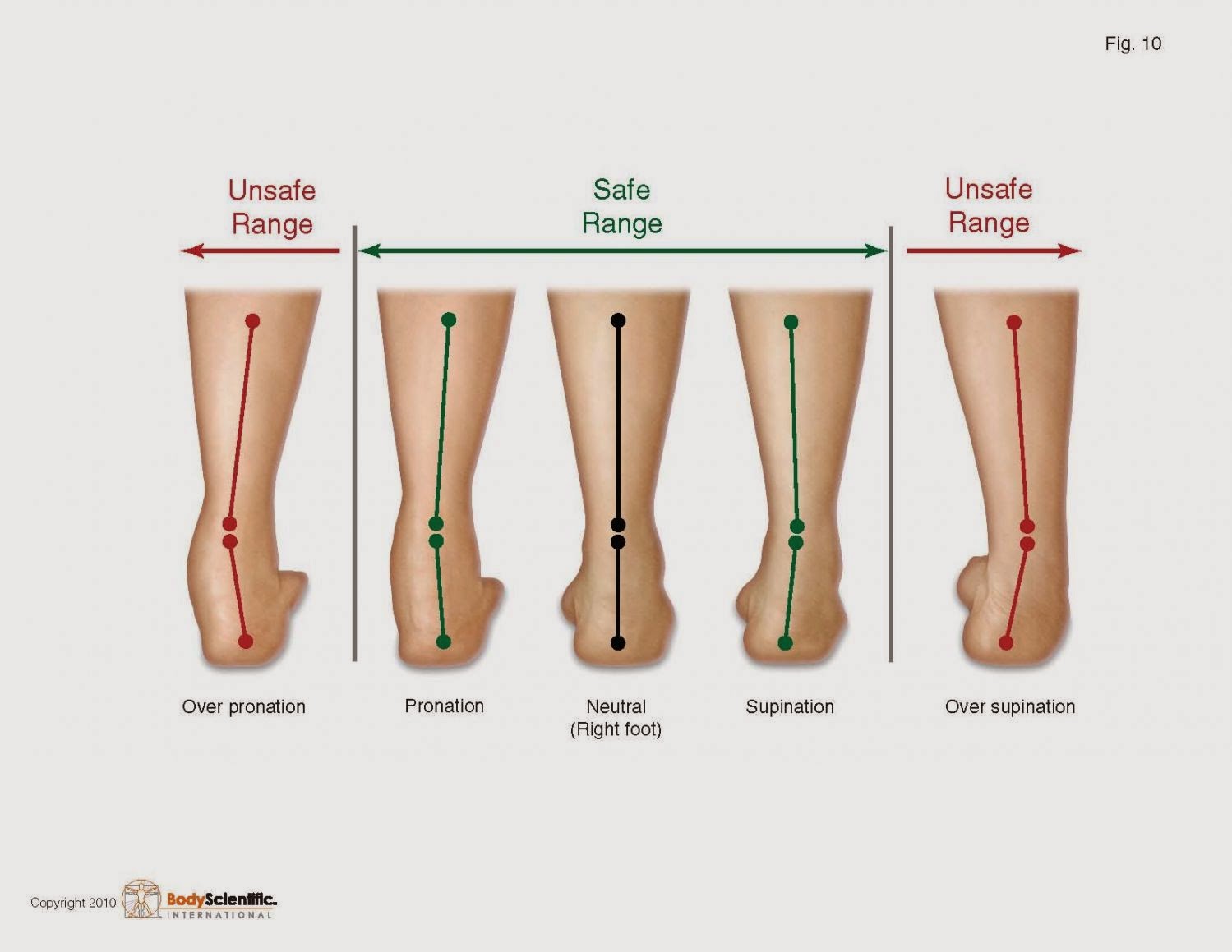 Little Mrs. Laurel Rhyne: Why proper running shoes are important.