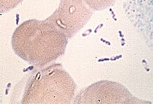 Pasteurella Multocida Bipolar Staining