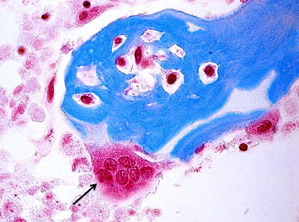 SOS BIOLOGIA CELULAR Y TISULAR: TEJIDO OSEO. CELULAS. Bone tissue.