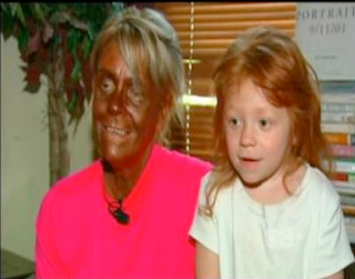 superdum: WTF Wednesdays: Tanorexia