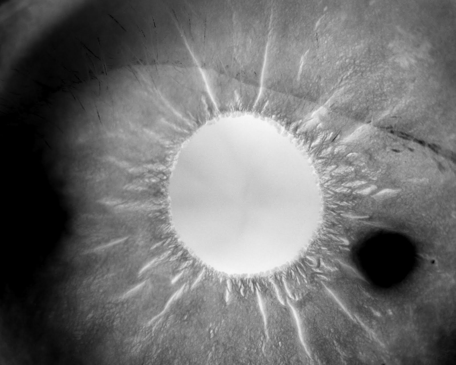 Modern & Multidimensional Iridology: Radial Furrows, Crypts & Closed ...