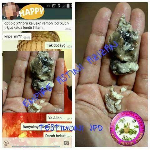 Pengedar Jamu Susuk Dara Nani: Testimoni - Jamu Pengantin Dara Rm65/10biji