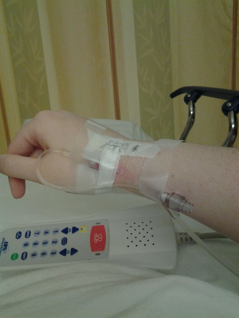 My Journey: Cystoscopy with hydrodistention