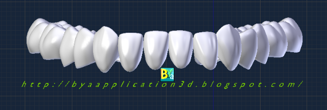 BLENDER et OSIRIX, simulation 3D, CAO 3D: Dents 3D