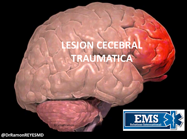 Lesión Cerebral Traumática Por Clinica Mayo Med Tac International Corp