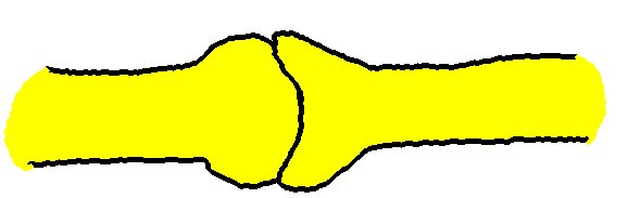 Enorca: Kodėl sąnariai traška, kas tos druskos ir ar verta pirkti ...