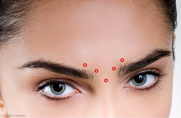 TRAITER LA RIDE DU LION ( OU DE LA GLABELLE )