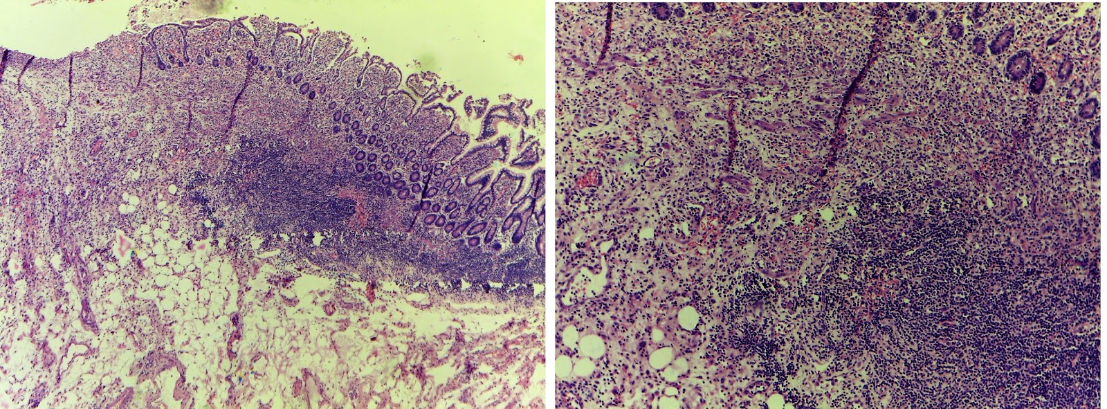 GASTROINTESTINAL AND LIVER HISTOLOGY PATHOLOGY ATLAS: ILEUM ...
