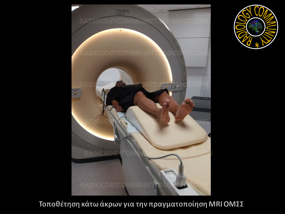Radiology Community: Μαγνητική Τομογραφία Οσφυϊκής Μοίρας Σπονδυλικής ...