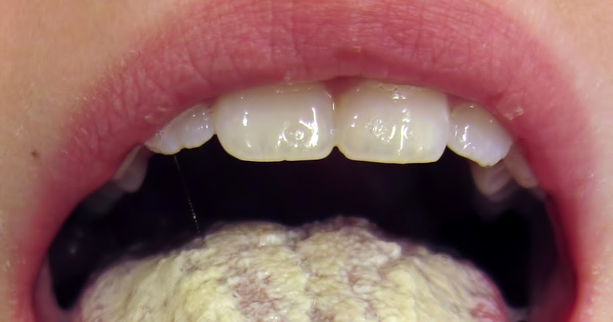 Ciencias de Joseleg: Infecciones oportunistas en la etapa de SIDA ...