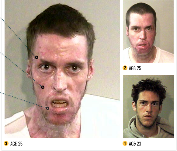 Kesan Pengambilan Methamphetamine / Syabu / Ice | V12gether