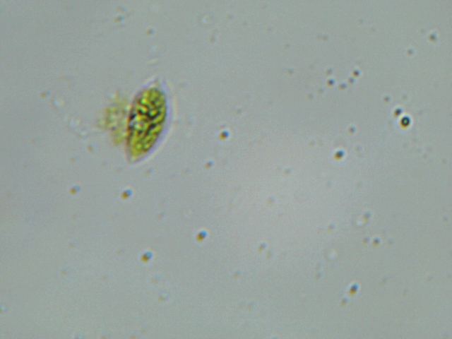 Amateur Algae culturing and cultivation : More Characium pringsheimii ...