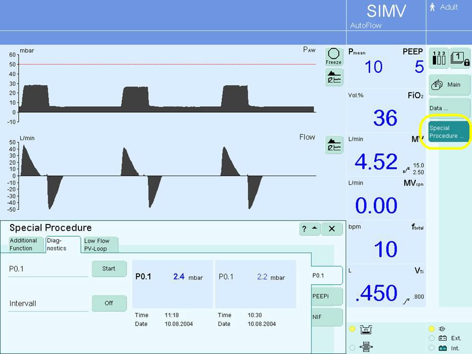 FREMITUS: Obtaining P0.1 on Various Ventilators