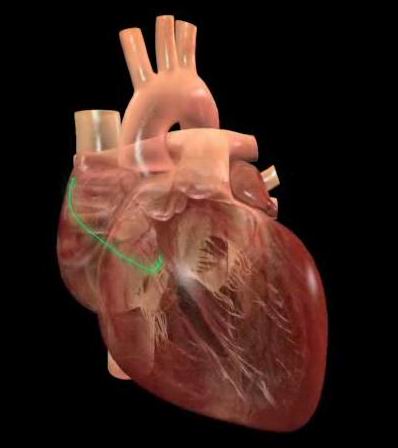 SISTEM KONDUKSI JANTUNG (The Heart’s Conduction System)