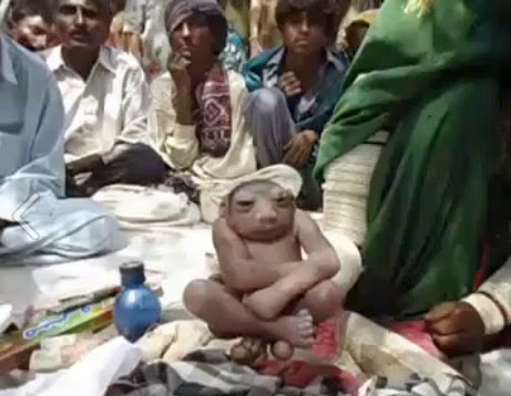Abnormal Baby Born in Kunri Sindh Pakistan (video) سندھ میں غیرمعمولی ...