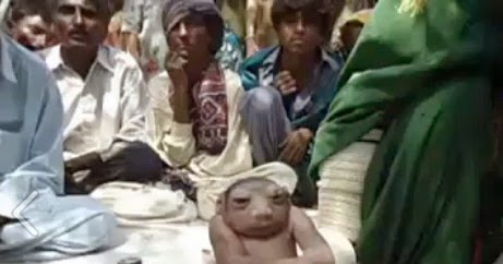 Abnormal Baby Born in Kunri Sindh Pakistan (video) سندھ میں غیرمعمولی ...