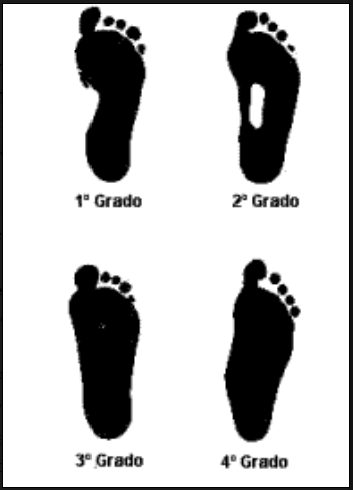 11:50: Grados de Pie Plano