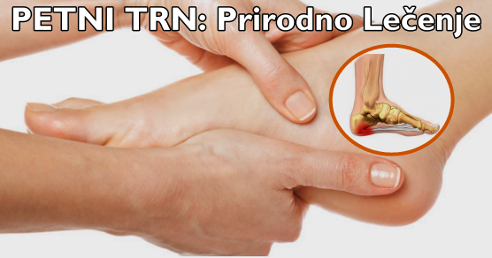 Šta je petni trn i kako se leči | PRIRODNO I ZDRAVO