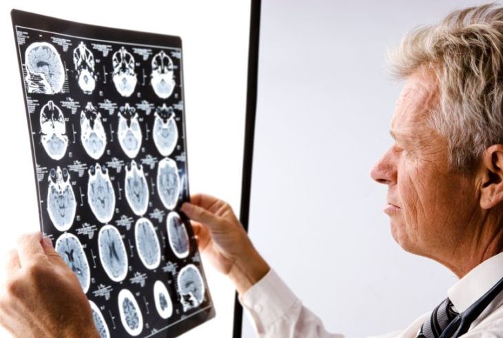 BIENVENIDO A DXN COSTARICA: ¿Cómo saber si usted necesita un neurólogo?