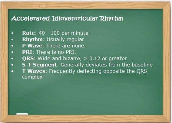 Float Nurse: Basic Rhythm Review: Ventricular Rhythms