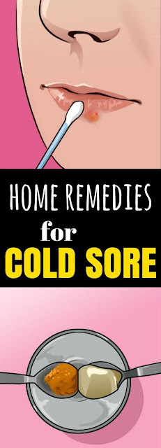 Clear Up A Cold Sore & 1 Of These 5 Home Remedies…!!! - HEALTH ROOTS