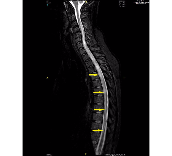 EL RINCÓN DE LA MEDICINA INTERNA. juanpedromacaluso@yahoo.com.ar ...