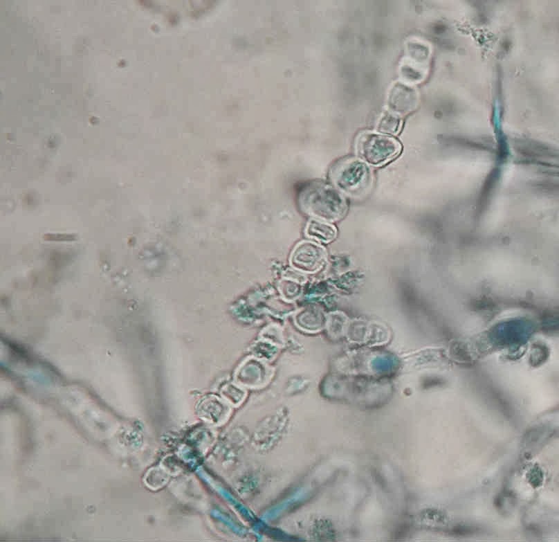 ATLAS MICOLOGIA: TRICHOPHYTON VERRUCOSUM