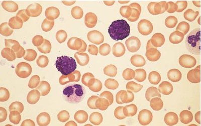 VETERINARY HEMATOLOGY DEXTERVET: Two basophils