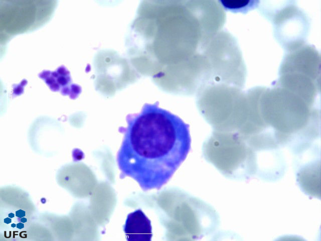 Células Sanguíneas: Plasmocito