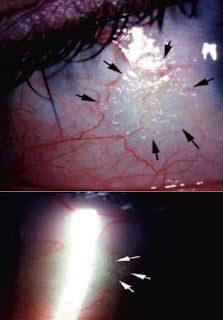 Reseñas de endocrinología y metabolismo: Déficit vitamínico: A y D