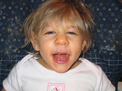 The Green Piece: National Microcephaly Day