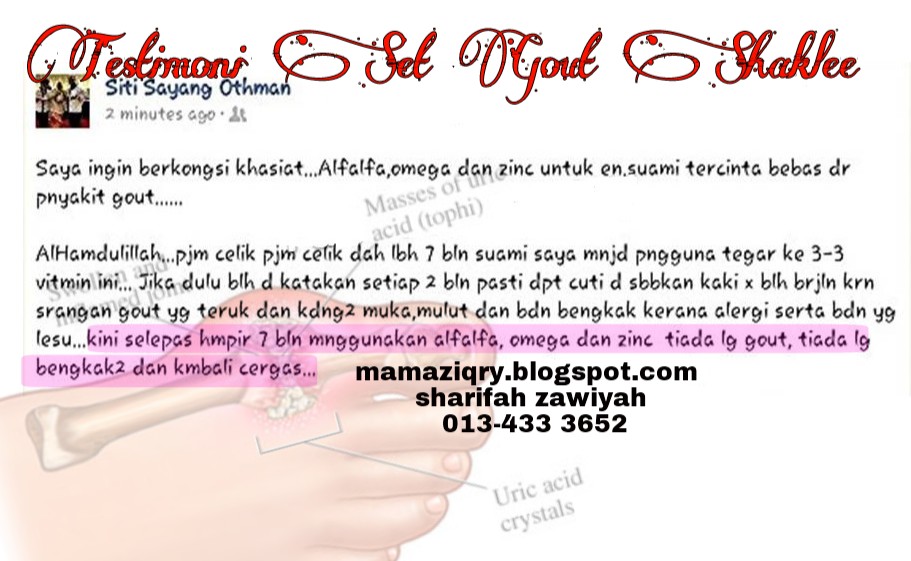 Punca GOUT Dan Bagaimana Cara Mengatasinya ~ Diari Mama Ziqry