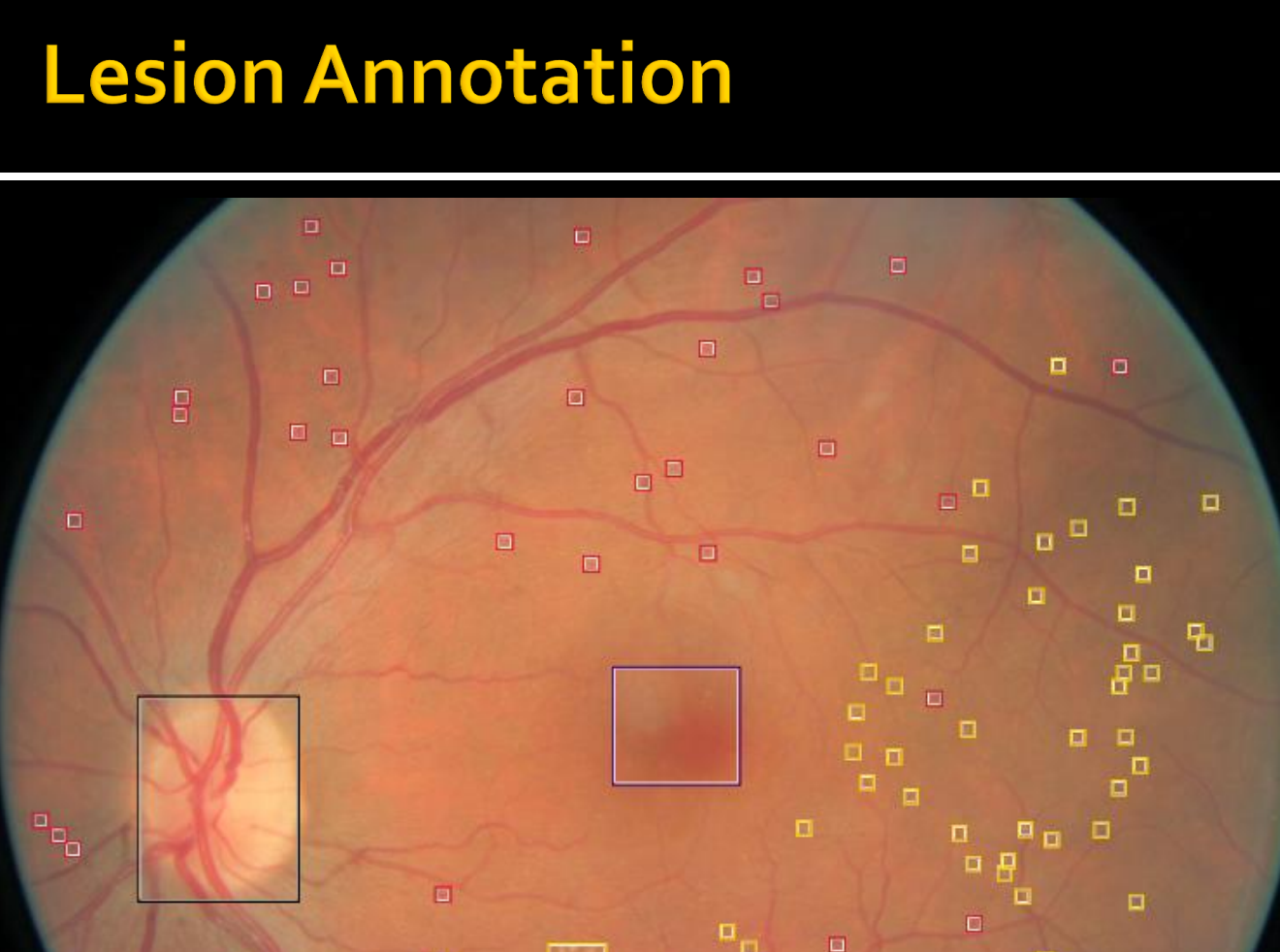Deep learning on Amazon Cloud used to Improve Diagnosis of chronic eye ...
