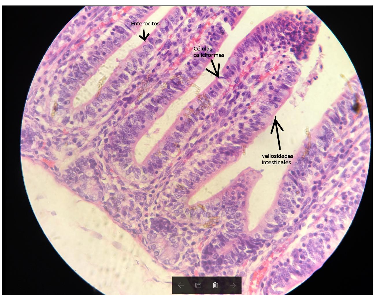 Histología del intestino delgado y grueso
