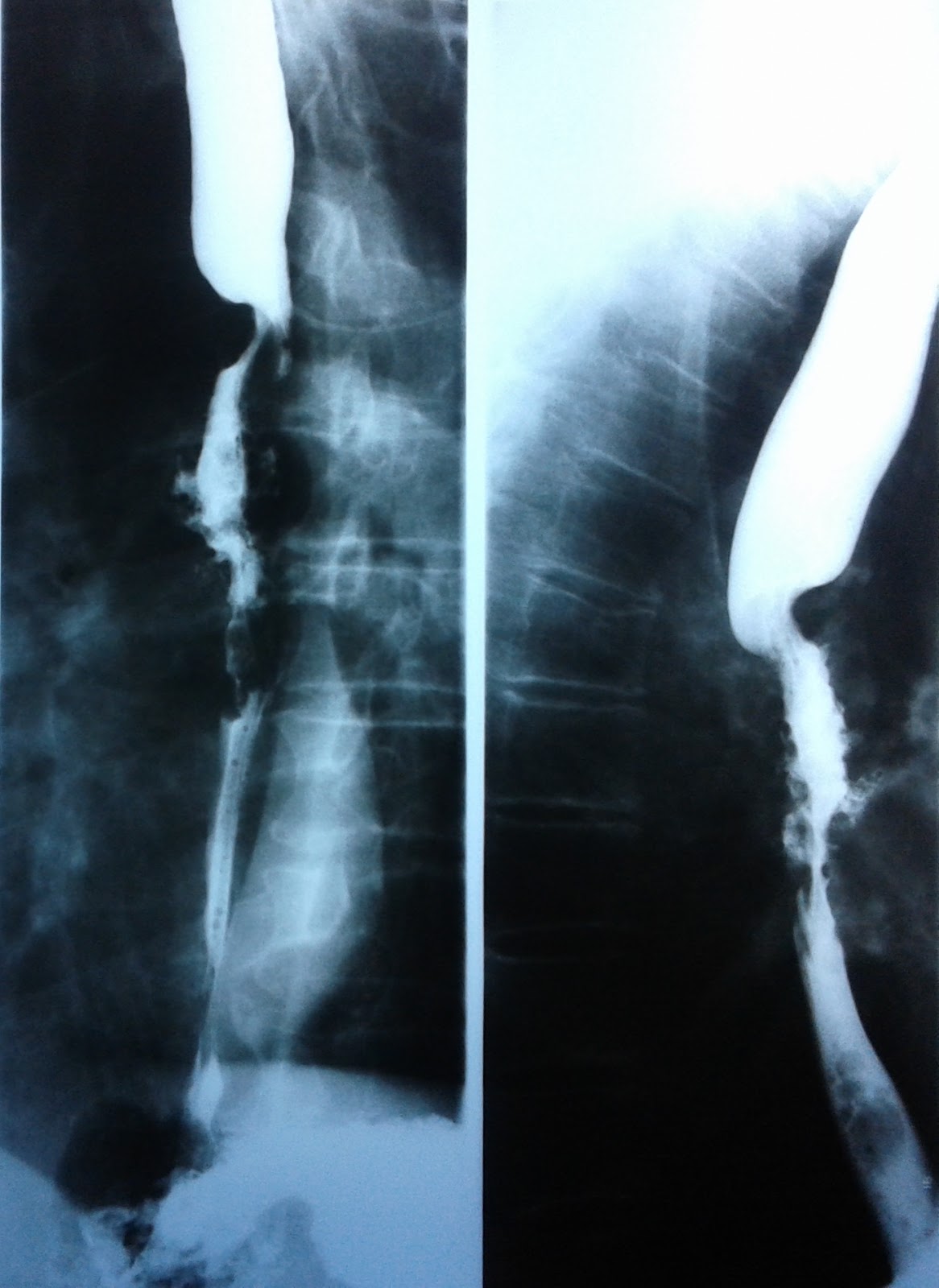 DICAS DE RADIOLOGIA - Tudo Sobre Radiologia: EXAME CONTRASTADO ...