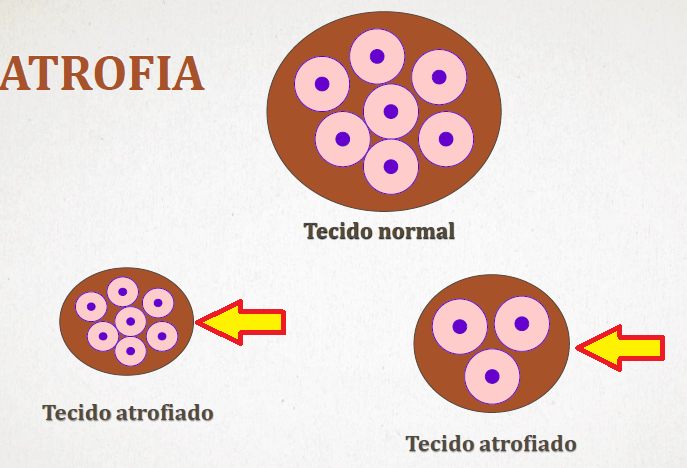 Função e Disfunção II: Atrofia