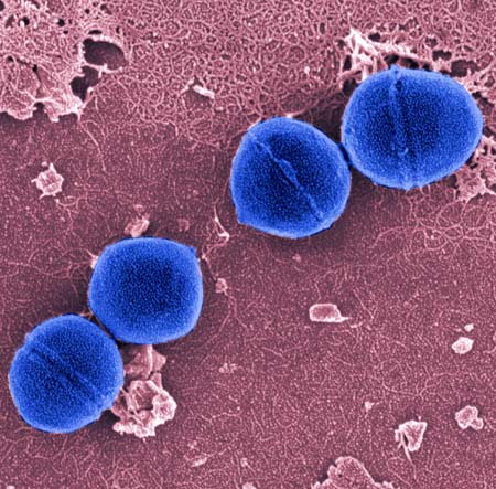 thunder bear and wren: Beta Strep