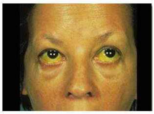 Penyakit yang disebabkan virus | Multi Info Pro