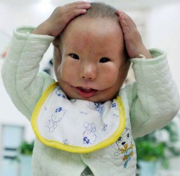 Baby With Two Faces : Kangkang - Looks Like He Is Wearing A Mask | Most ...