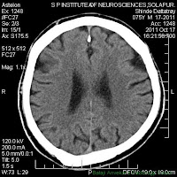 Dr Balaji Anvekar FRCR: Intracranial calcifications