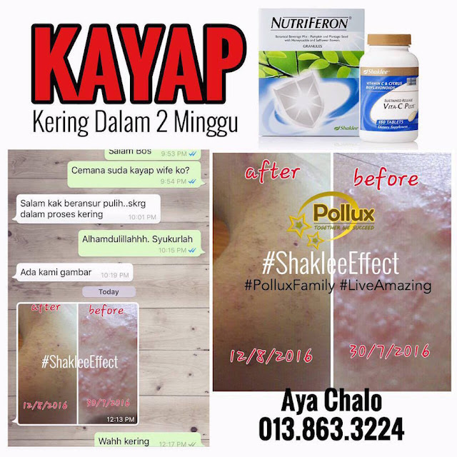 Panduan dan Tips Kesihatan Vitamin Semulajadi - penawar kayap tapak ...